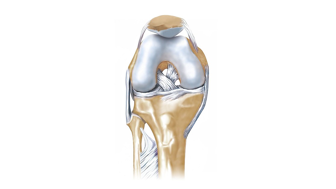 Cruciate ligament tear I Differences, treatment & therapy I medi